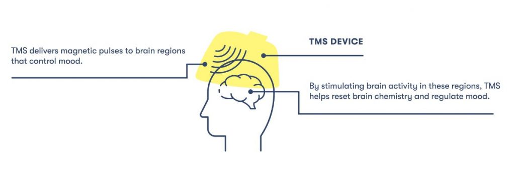 Services - TMS - Heading Health