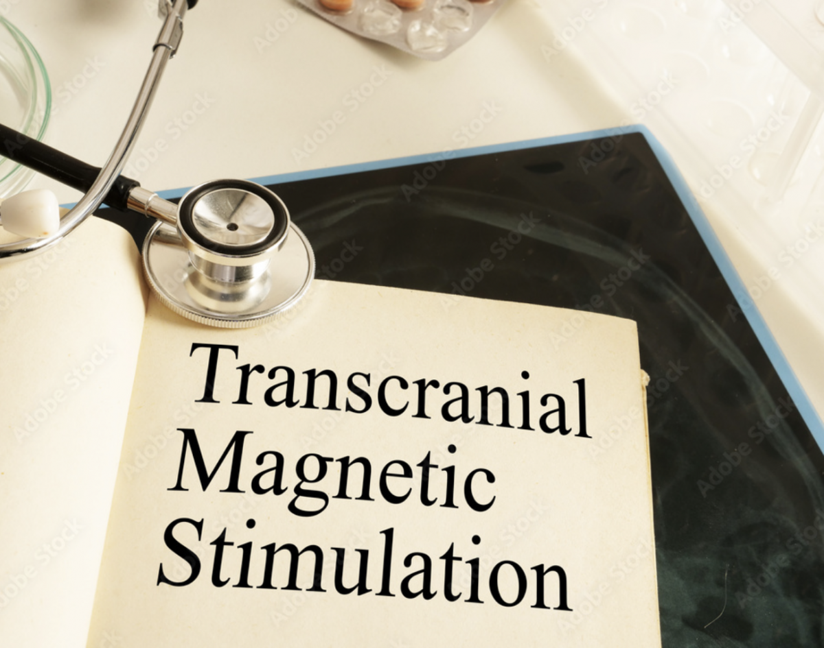 The Basics of Transcranial Magnetic Stimulation - Heading Health